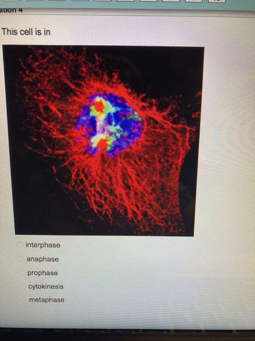 Solved This cell is in interphase anaphase prophase | Chegg.com