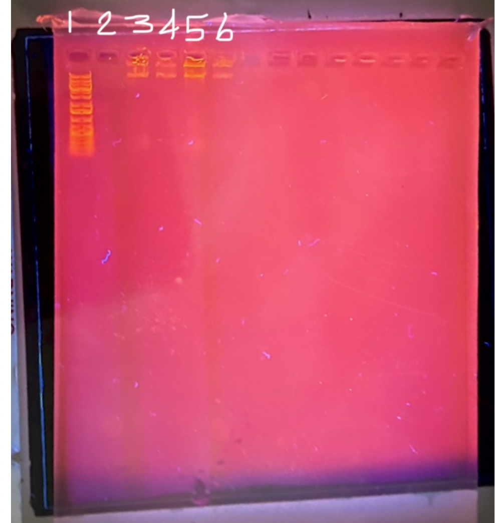 Solved Interpret the gel electrophoresis | Chegg.com