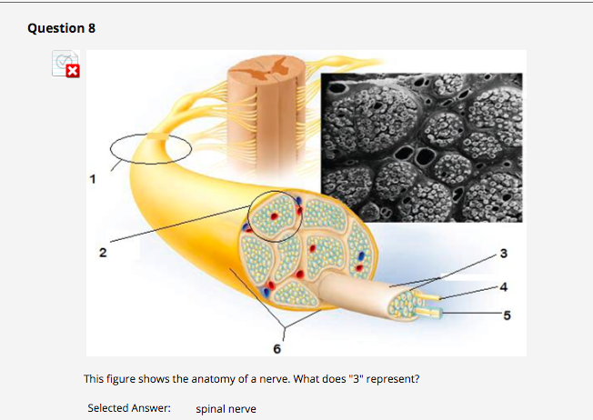 Solved Question 16 Figure 3 ANS Pathway Use Figure 3 to | Chegg.com Solved Question 16 Figure 3 ANS Pathway Use Figure 3 to | Chegg.com