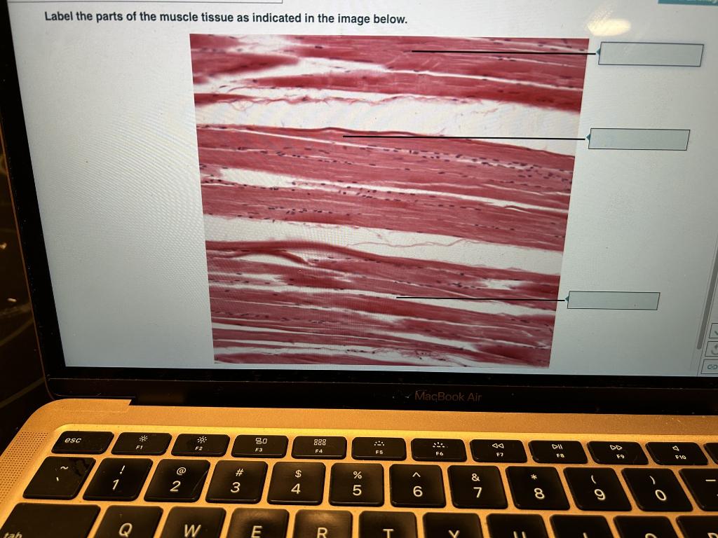 [Solved]: Label the parts of the muscle tissue as indicated