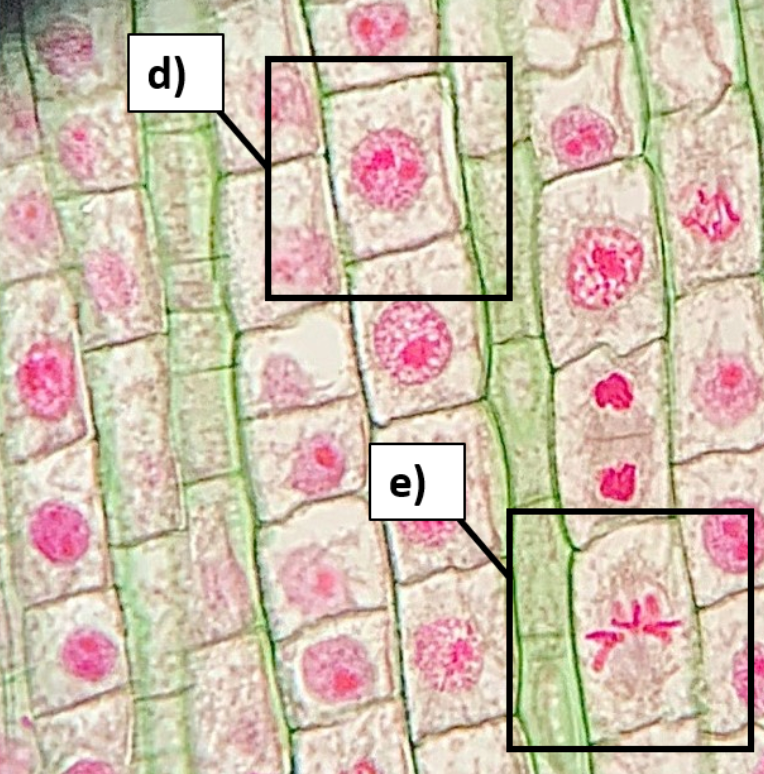 Onion Cell Under Microscope Labeled