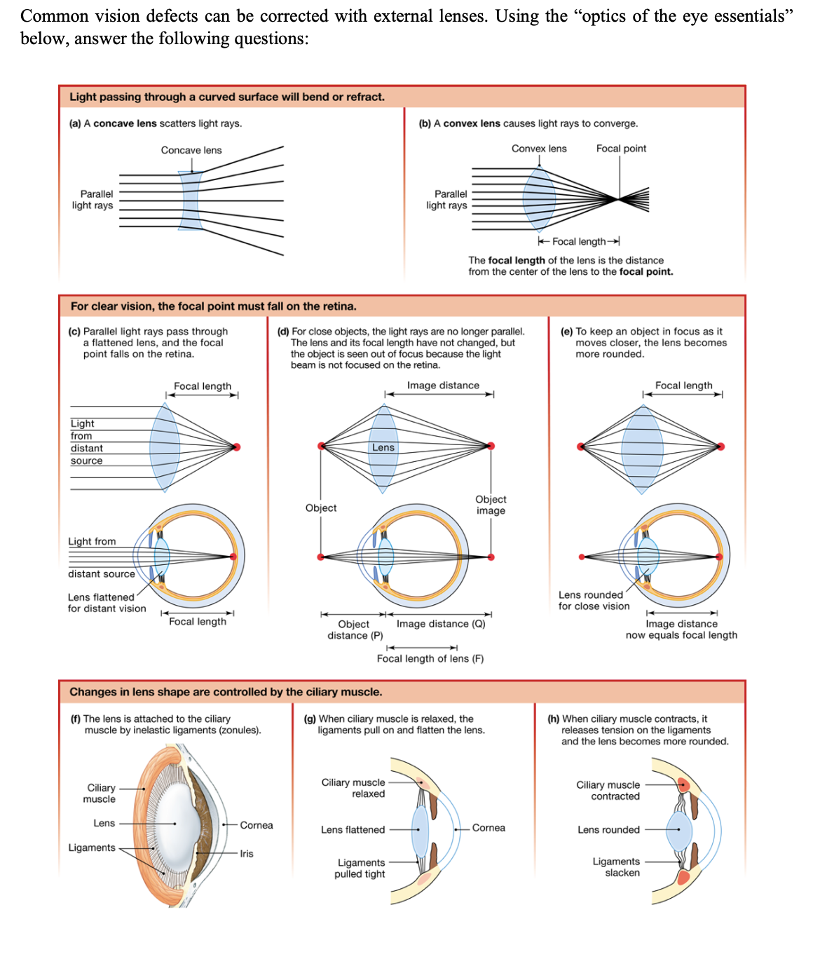 Solved Common vision defects can be corrected with external | Chegg.com