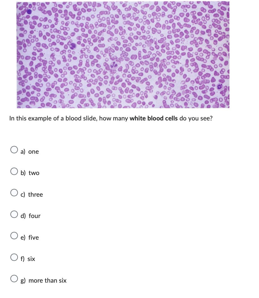 Solved In this example of a blood slide, how many white | Chegg.com