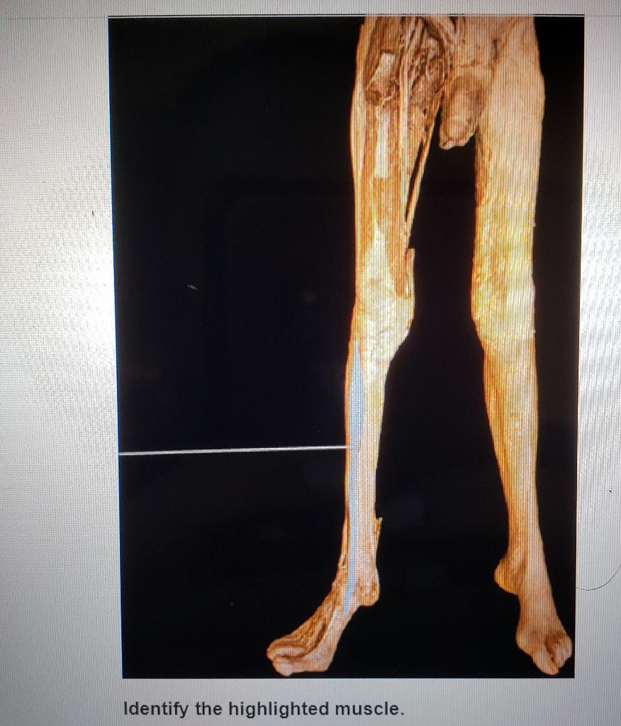 Solved Identify the highlighted muscle. Identify the | Chegg.com
