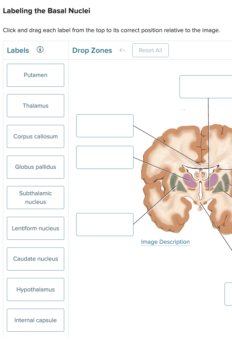 Solved Labeling the Basal NucleiClick and drag each label | Chegg.com