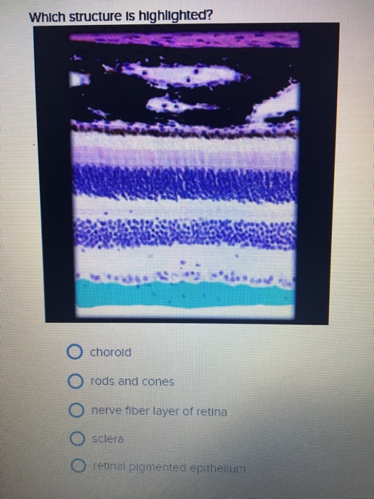 Solved Which structure Is highlighted? Choroid rods and | Chegg.com