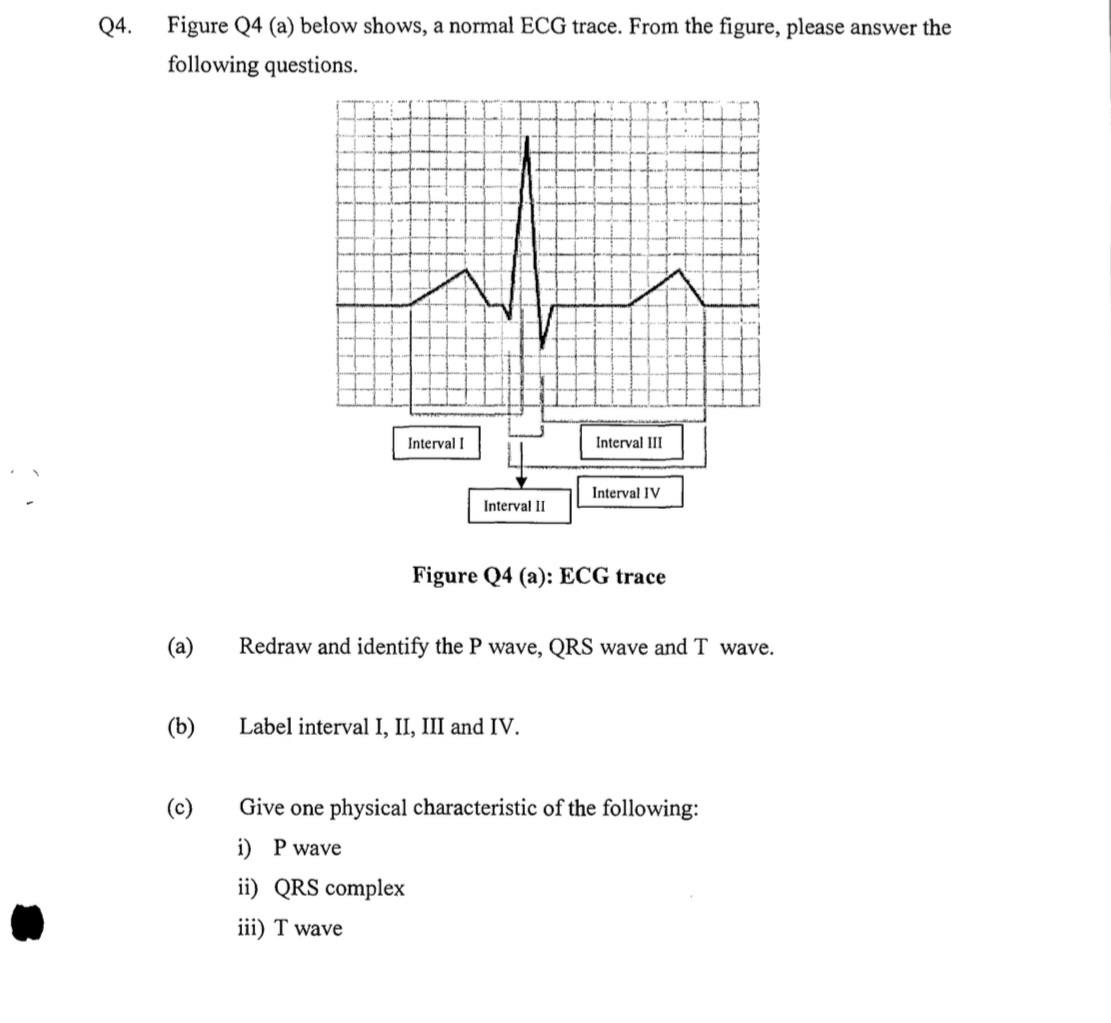 4. Figure Q4 (a) below shows, a normal ECG trace. | Chegg.com