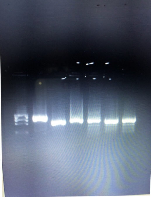 Solved In genetics we did the chromosome 16 PV92 PCR lab. | Chegg.com