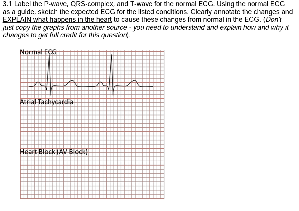 Solved 3.1 Label the P-wave, QRS-complex, and T-wave for the | Chegg.com