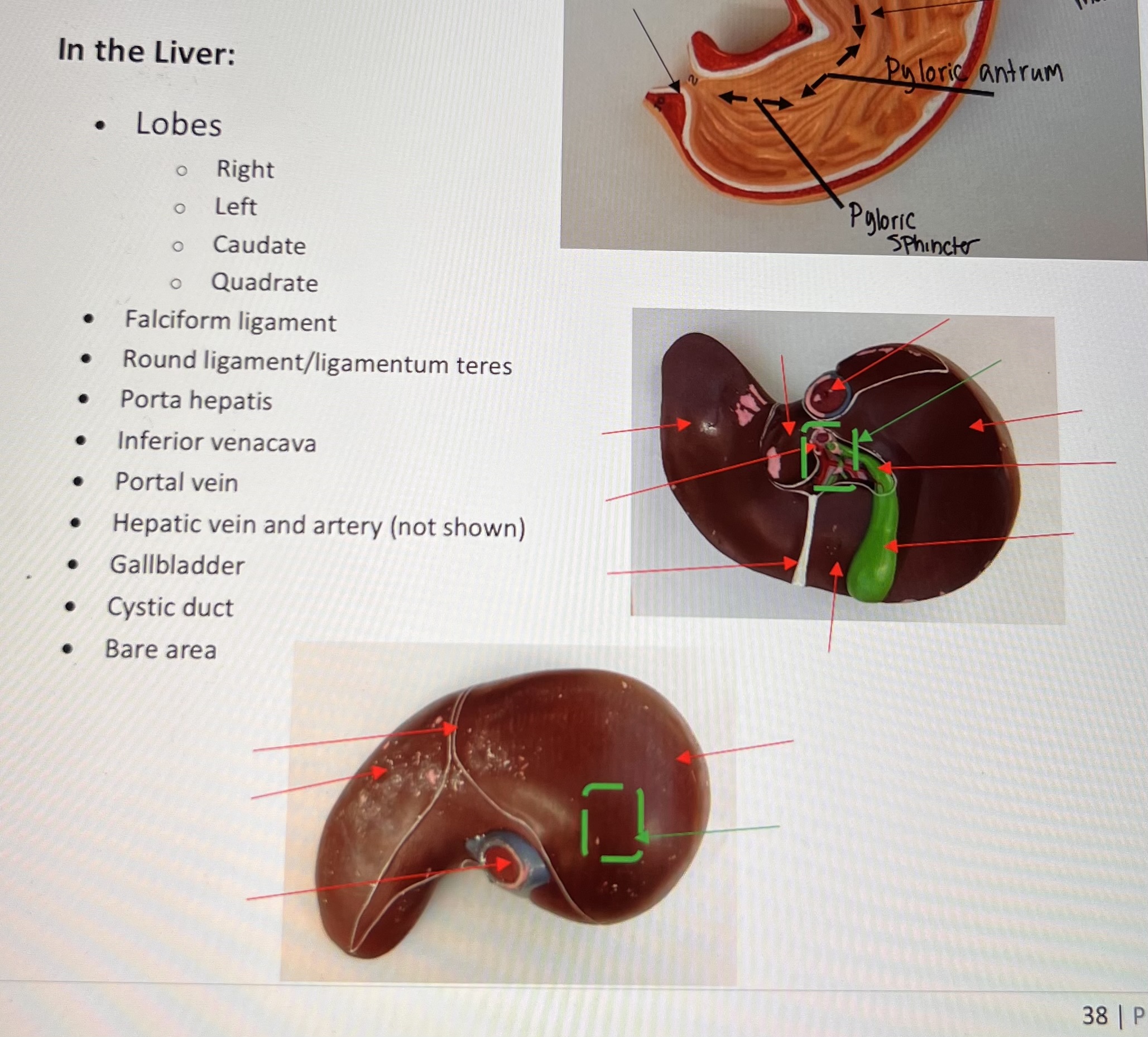 Liver Model Falciform Ligament