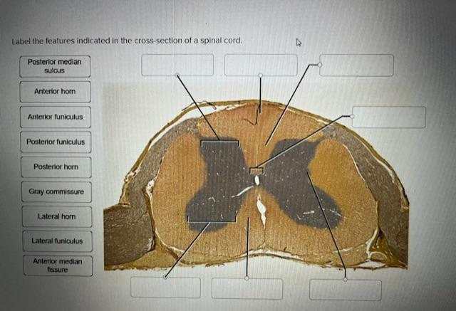 Solved Label the features indicated in the cross-section of | Chegg.com