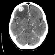 Solved Load the CT scan (1 slice of a 3D volume) into | Chegg.com