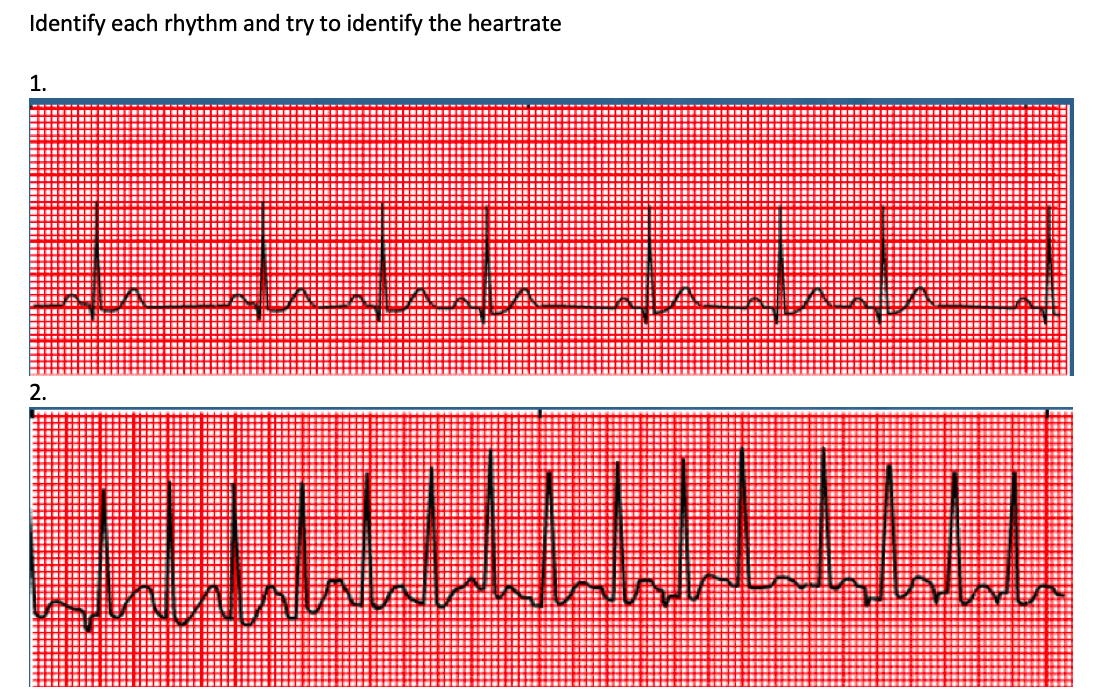 Solved Identify each rhythm and try to identify the | Chegg.com