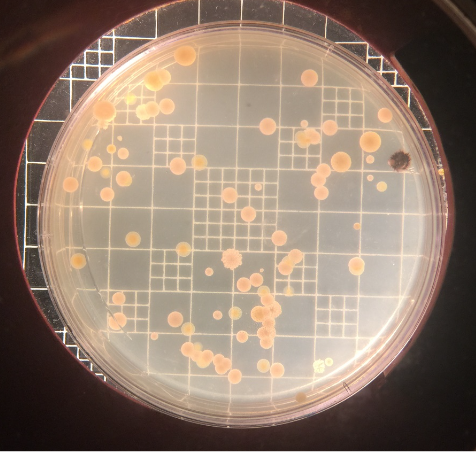 Solved Interpretation of Results in CFU: 1. Make the total | Chegg.com