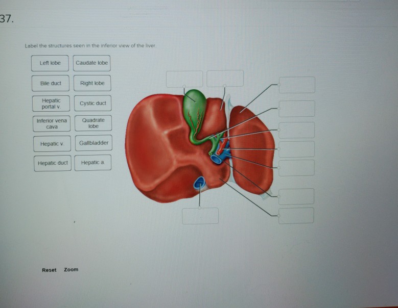 Solved 37 Label the structures seen in the inferior view of | Chegg.com