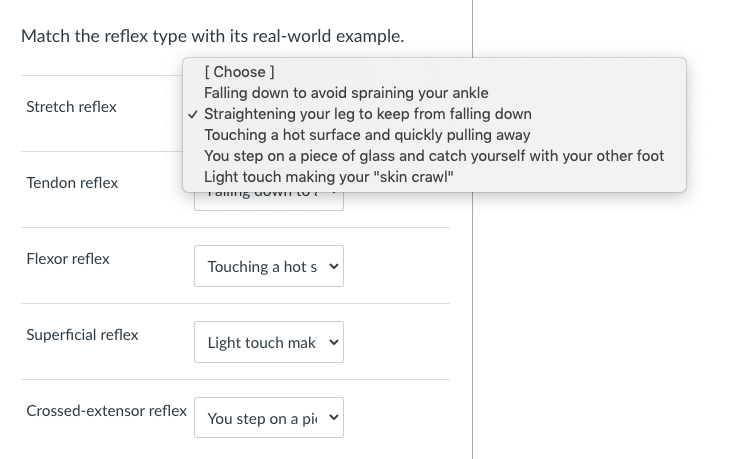 Solved Match the reflex type with its real-world example. | Chegg.com