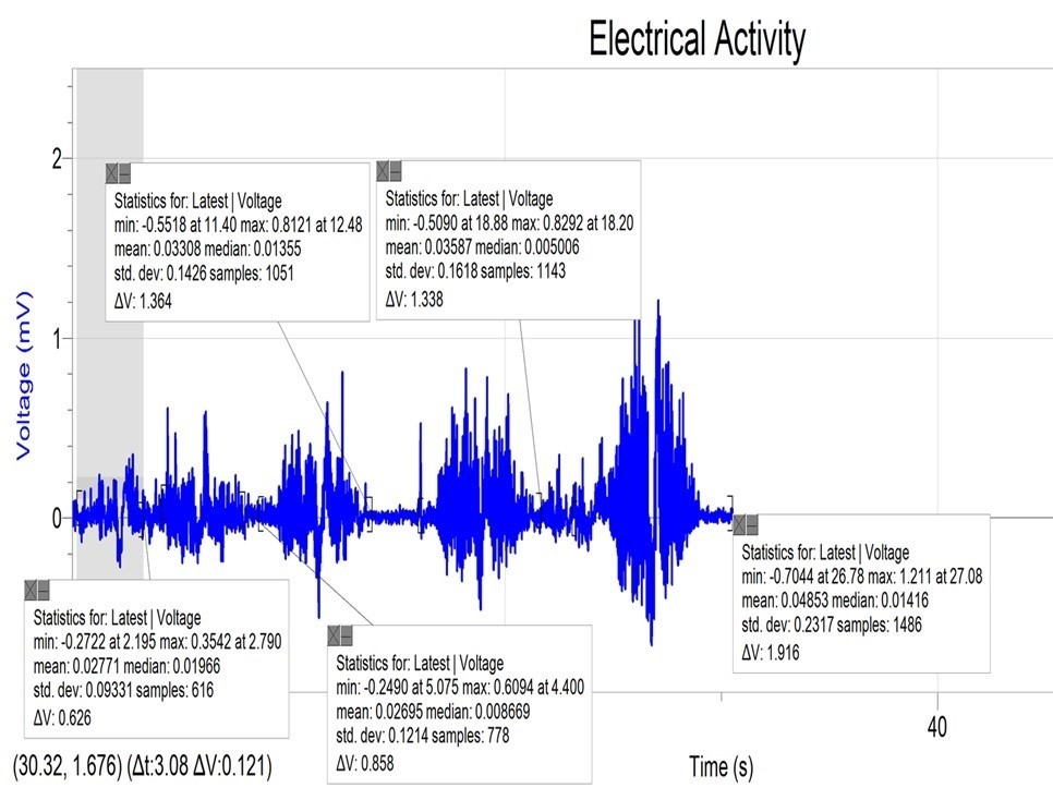 Solved Electromyography (EMG) Experiment Worksheet In | Chegg.com