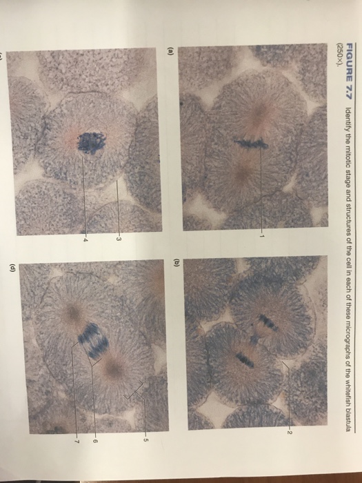 Solved FIGURE 7.7 (250x). Identify the mitotic stage and | Chegg.com Solved FIGURE 7.7 (250x). Identify the mitotic stage and | Chegg.com