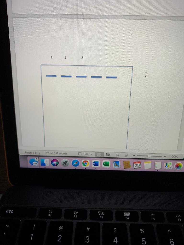 Solved You load a DNA ladder with fragment sizes of 2000, | Chegg.com