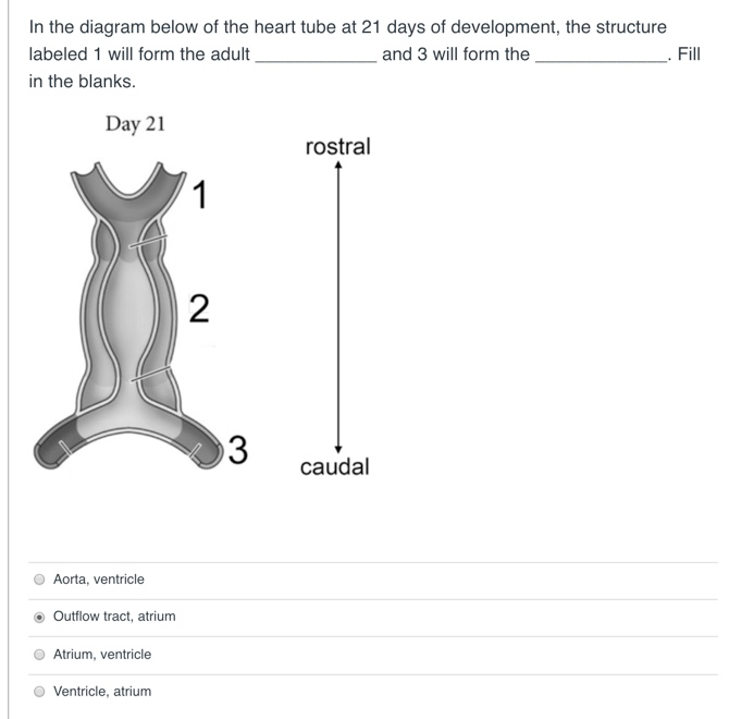 Solved In the diagram below of the heart tube at 21 days of | Chegg.com