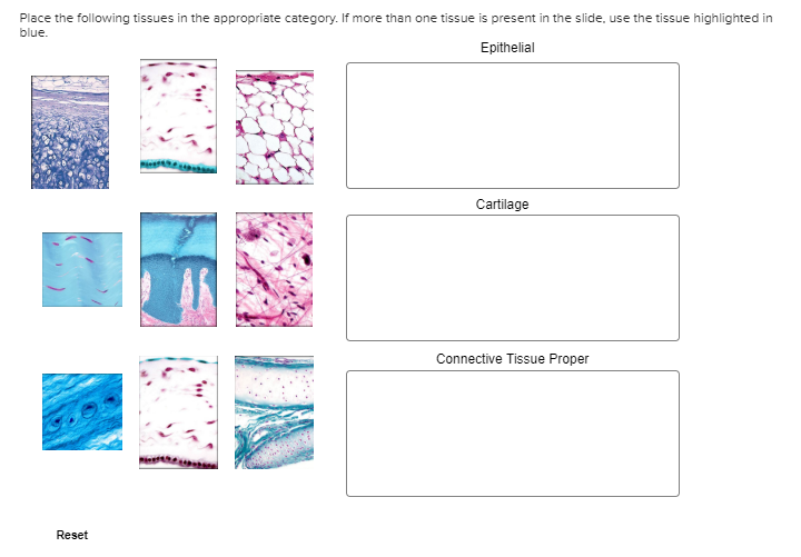 Solved Place the following tissues in the appropriate | Chegg.com