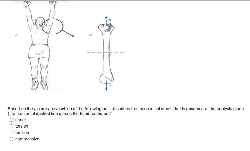 Solved Which of the following reflexes occurs in your right | Chegg.com