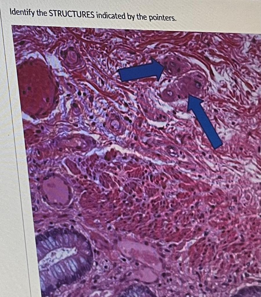 Identify the STRUCTURES indicated by the pointers. | Chegg.com