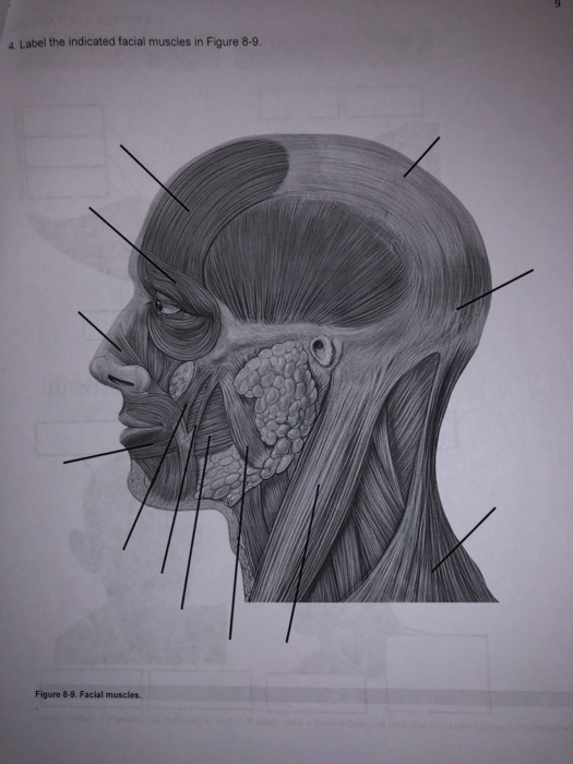 Solved Epicranial aponeurosis Epicranius frontalis | Chegg.com