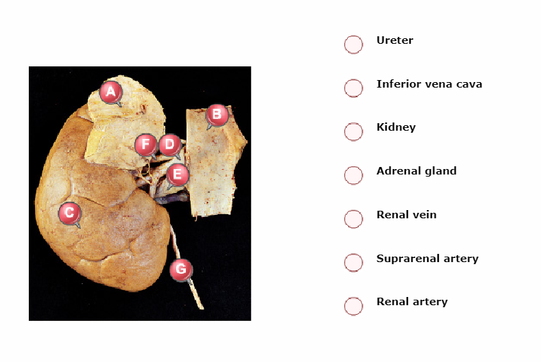 Solved Ureter Inferior vena cava Kidney Adrenal gland Renal | Chegg.com