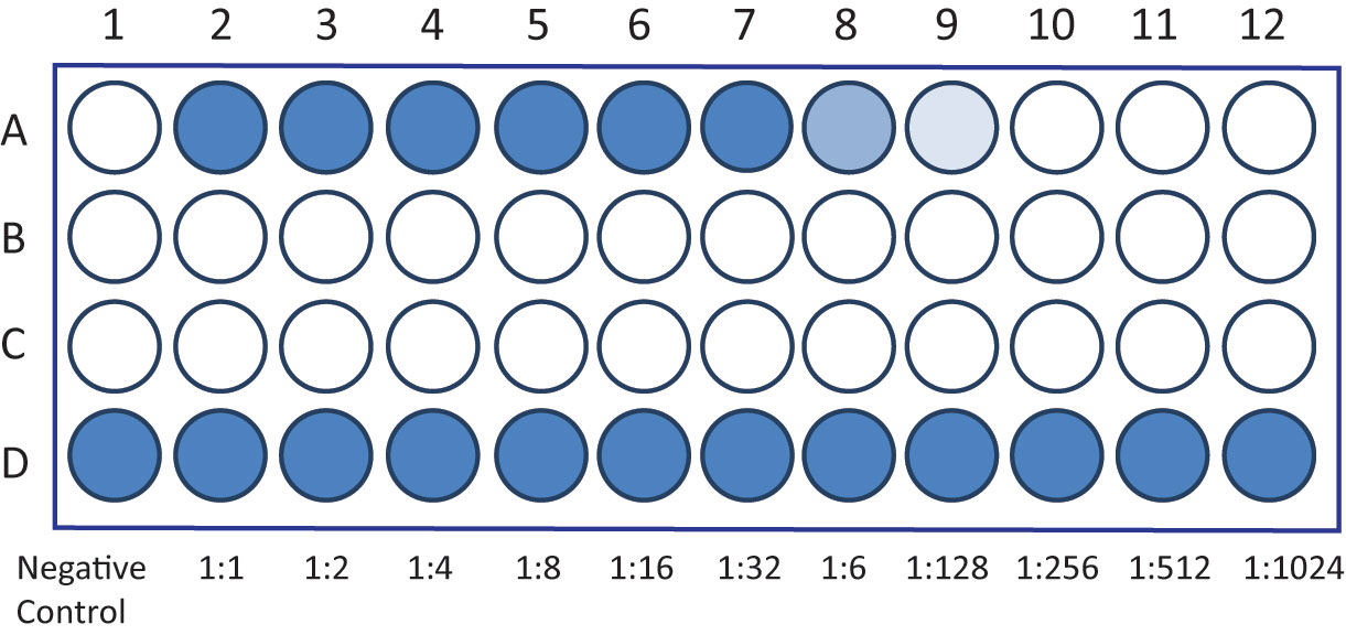 Solved The ELISA results below are for a patient suffering | Chegg.com