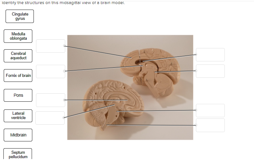 Solved Identify the structures on this midsagittal view of a | Chegg.com