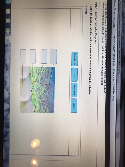 Solved To review the body's Label the cause of infection and | Chegg.com Solved To review the body's Label the cause of infection and | Chegg.com