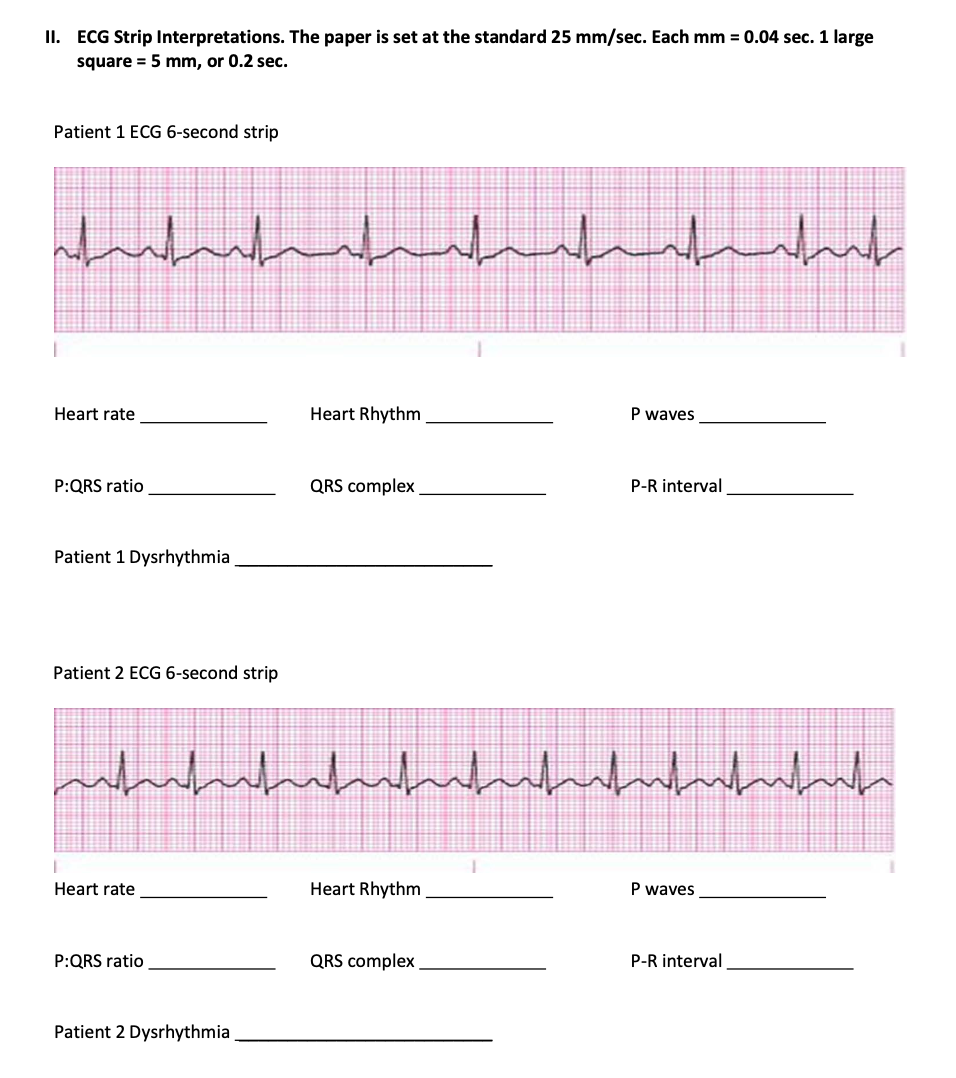 Solved E IT, ECG Strip Interpretations. The paper is set at | Chegg.com