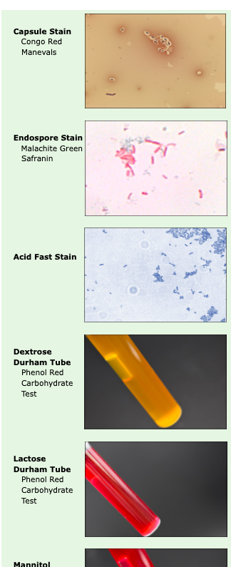 Solved Starch Agar + Iodine Blood Agar Catalase Test + | Chegg.com