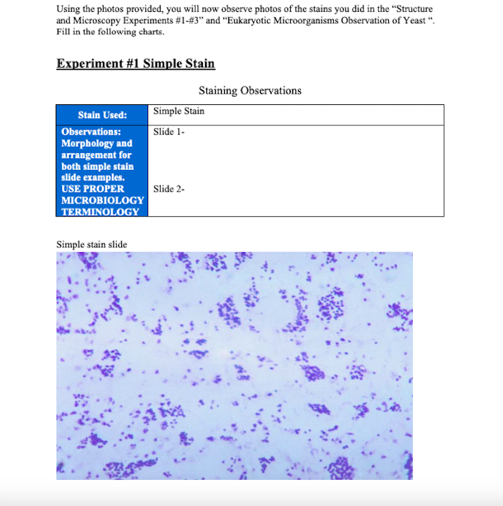 Solved Experiment #1 Simple Stain Using the photos provided, | Chegg.com