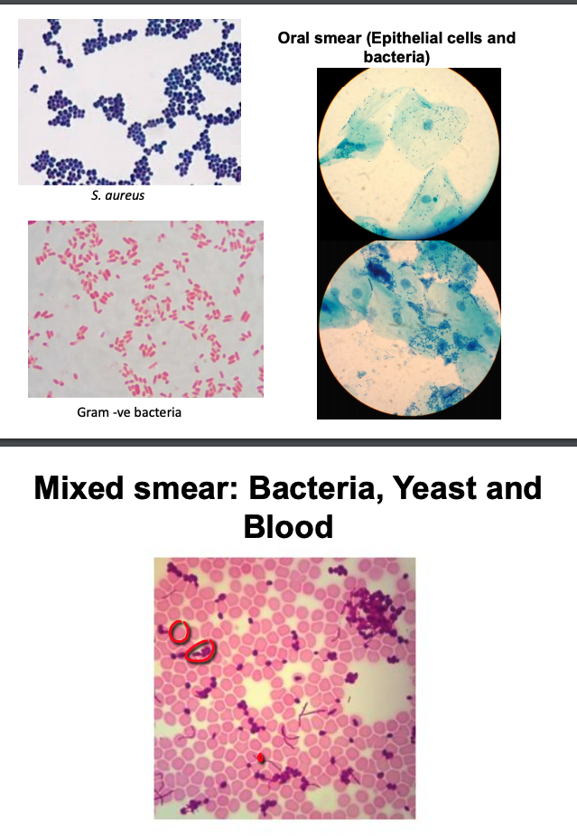 Solved Preparation Of Smear and hit fixing 1.Take 1-2 loops | Chegg.com