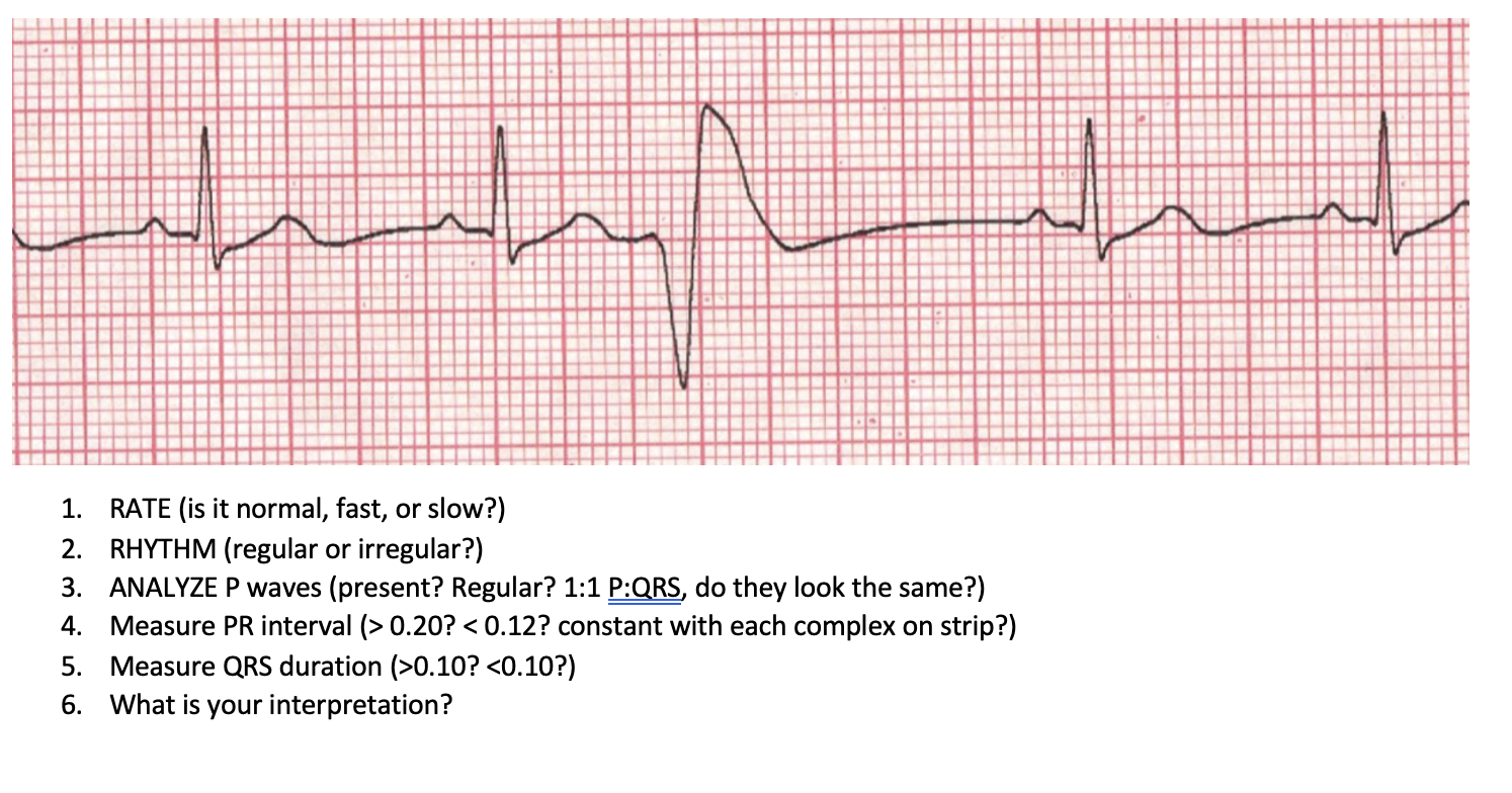 Solved 1. RATE (is it normal, fast, or slow?) 2. RHYTHM | Chegg.com