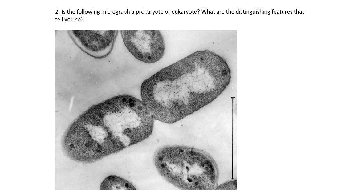 Solved 2. Is the following micrograph a prokaryote or | Chegg.com