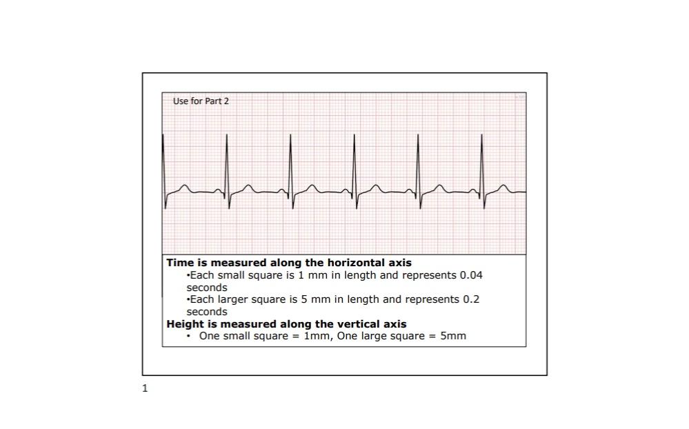 Solved 2. Use ECG strip provided and determine the | Chegg.com