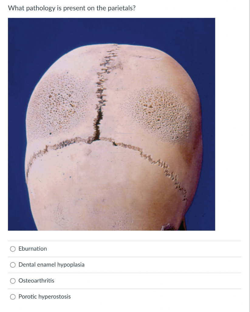 Solved What pathology is present on the parietals? | Chegg.com