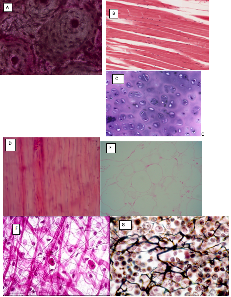 Dense Regular Connective Tissue Vs Smooth Muscle