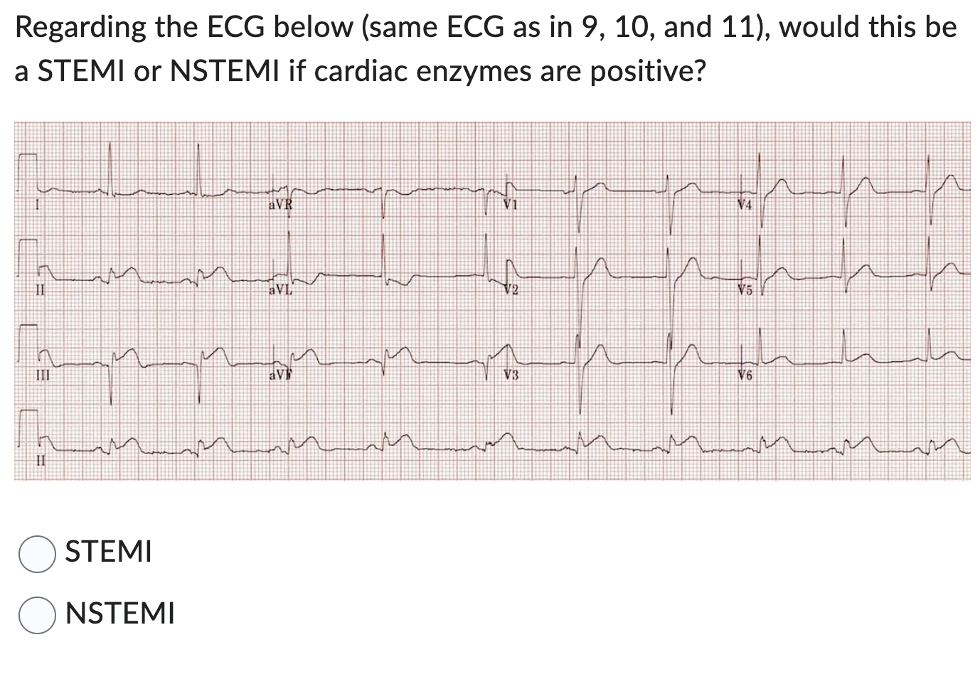 Solved Regarding the ECG below (same ECG as in 9,10 , and 11 | Chegg.com