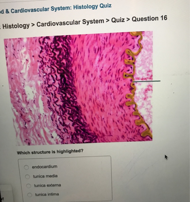 Solved: D & Cardiovascular System: Histology Quiz Histolog... | Chegg.com