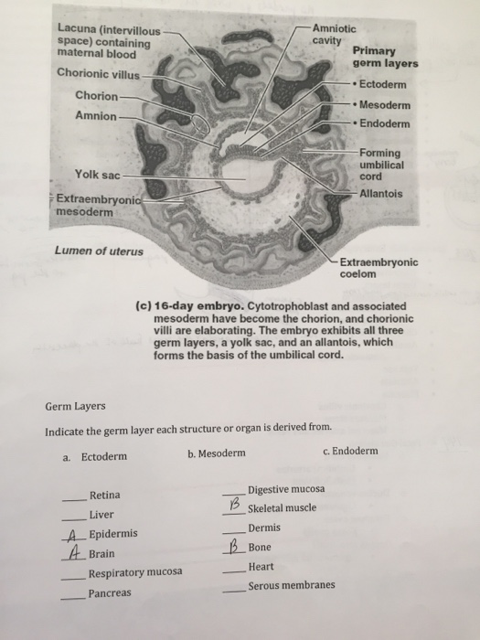 Solved Lacuna (intervillous space) containing maternal blood | Chegg.com