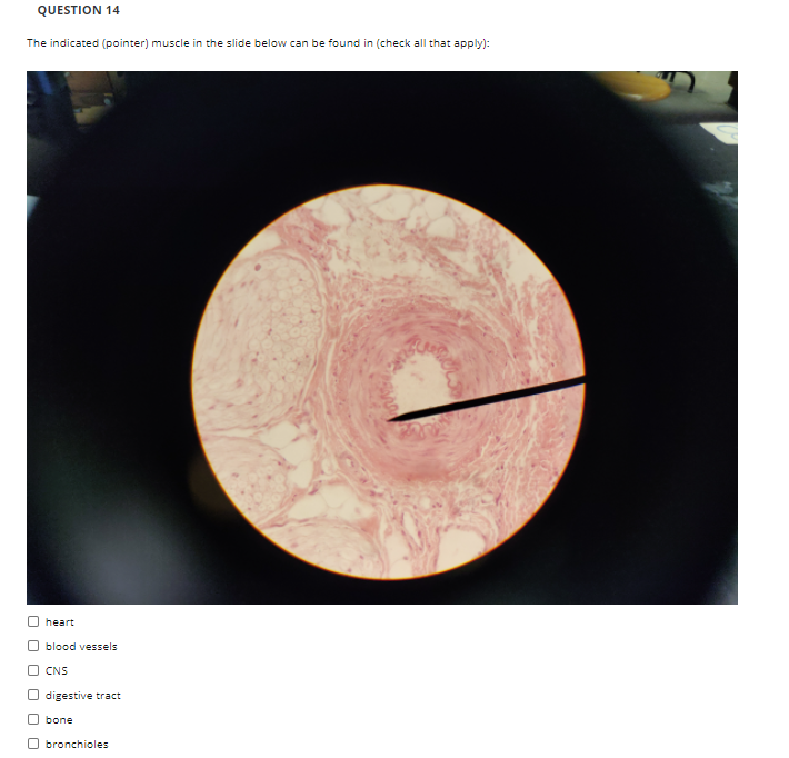 Solved QUESTION 14 The indicated (pointer) muscle in the | Chegg.com