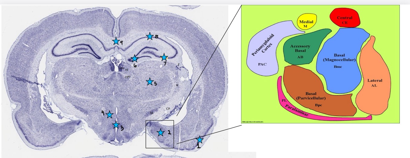 Solved Identify the structures: Identify: Hippocampus (CA1, | Chegg.com