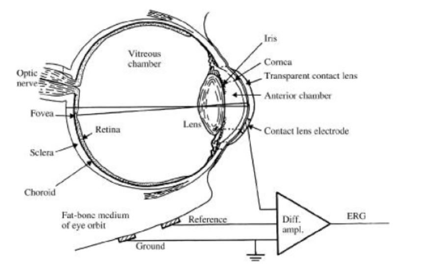 Design a system to measure the electroretinogram | Chegg.com