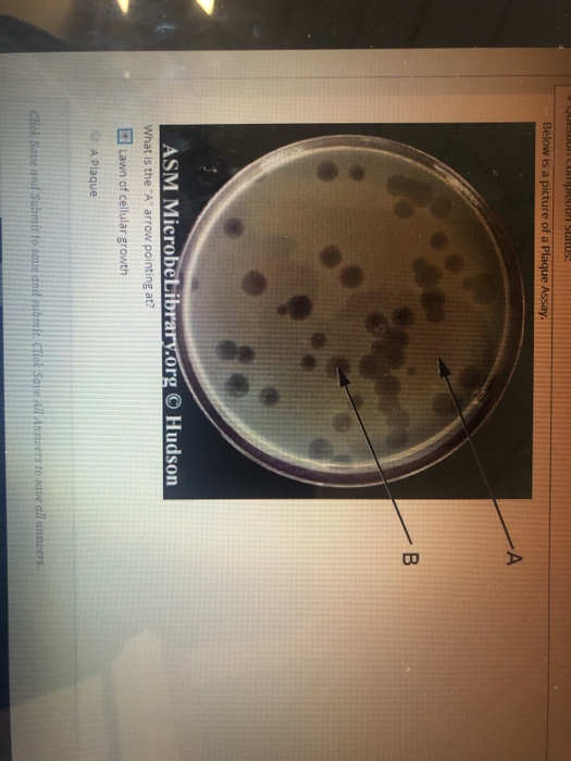 Solved is a re of a ASM MicrobeLibrary.org t is the A" arrow | Chegg.com