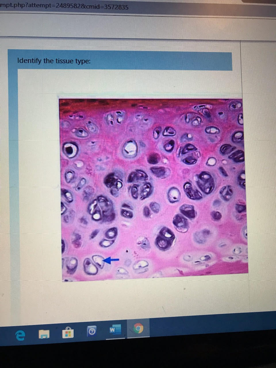 Solved Path: p What is the predominant cell type in this | Chegg.com
