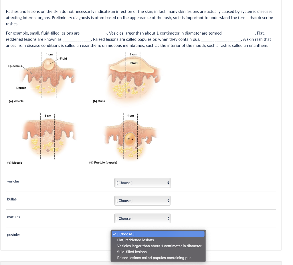 Solved Rashes and lesions on the skin do not necessarily | Chegg.com